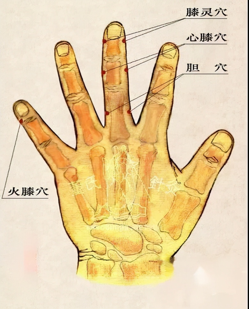 TCM acupuncture and lower extremity disease prescription 5 - iNEWS