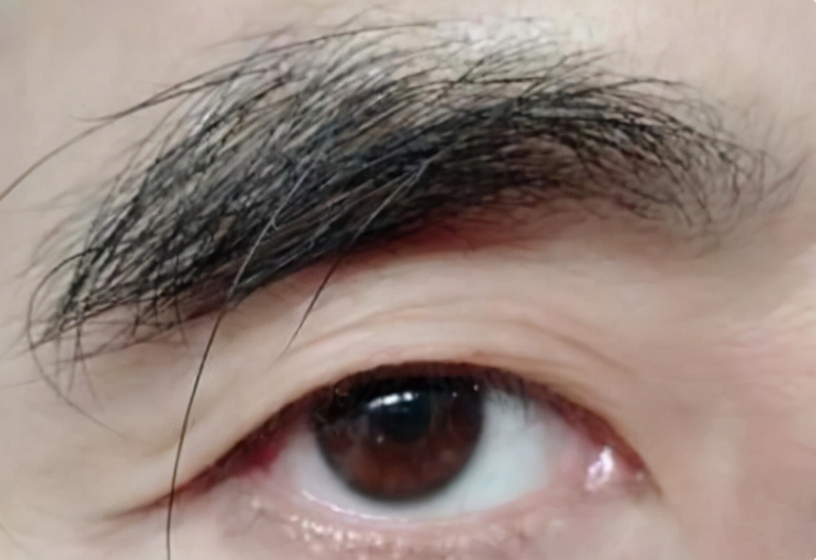 What does it mean for men to have longer eyebrows after 50 years of age ...