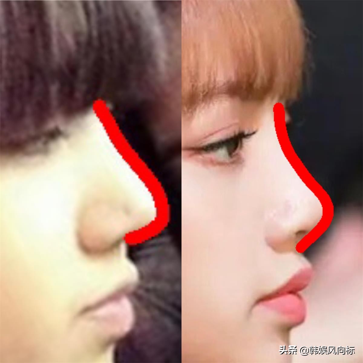 How does BLACKPINK Lisa's nose compare to before her debut? Has she ...