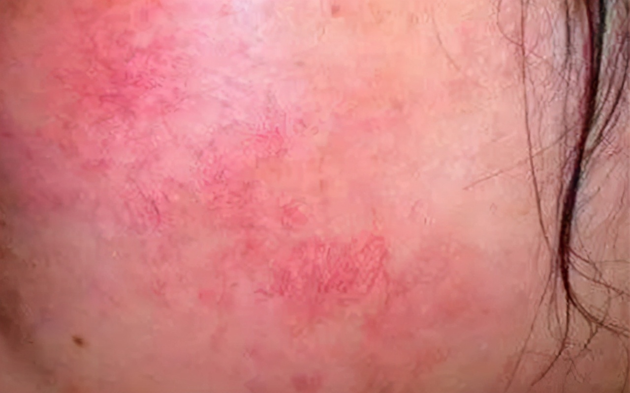 What should I do if I are allergic to all skin care products on the ...