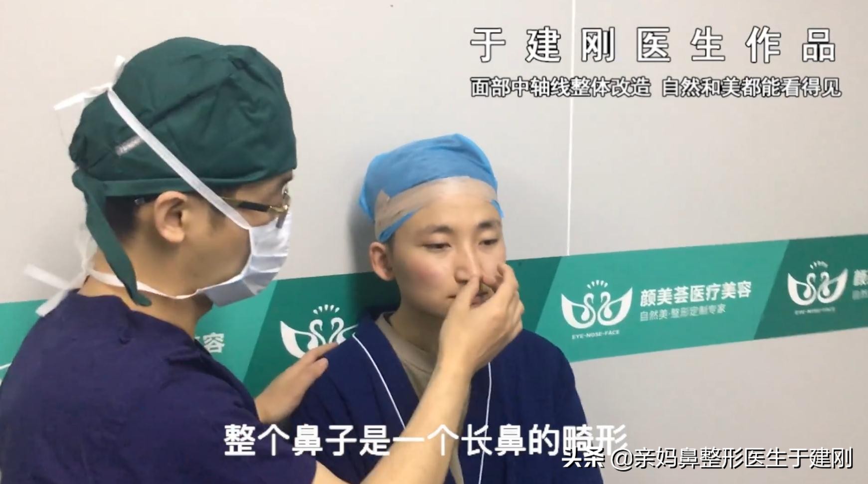 What is the effect of men's rhinoplasty? Let's take a look at the ...