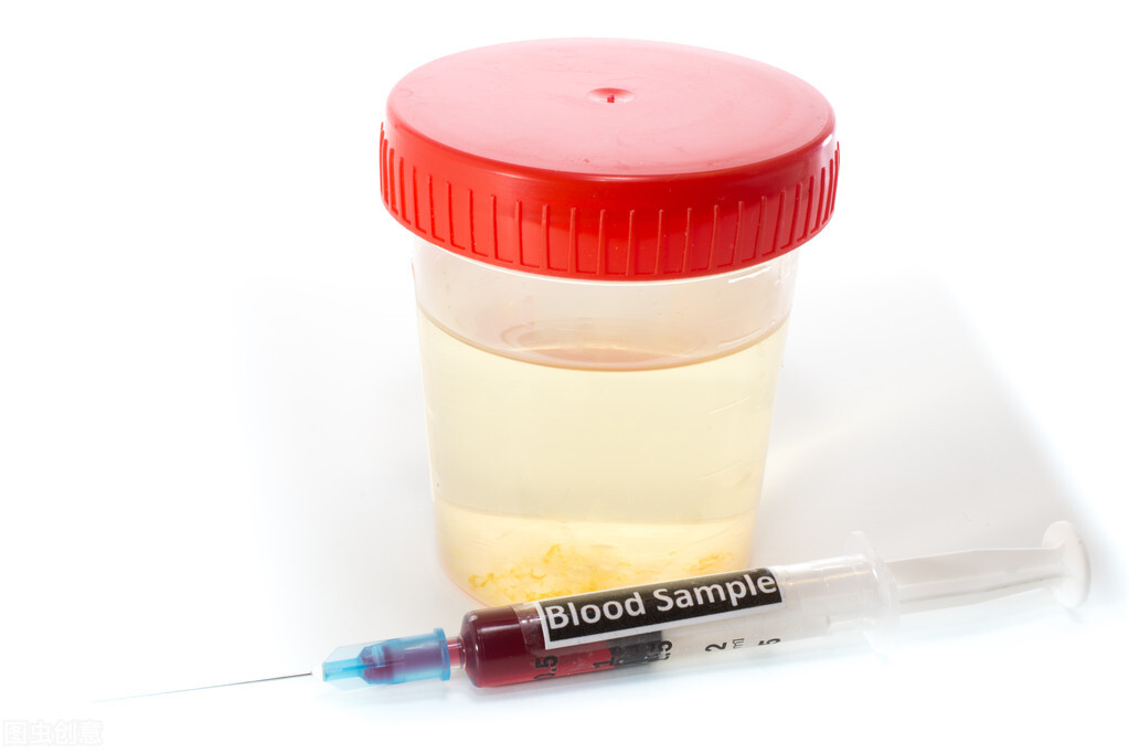 What are the main indicators of urine routine?Reminder: Be careful if ...