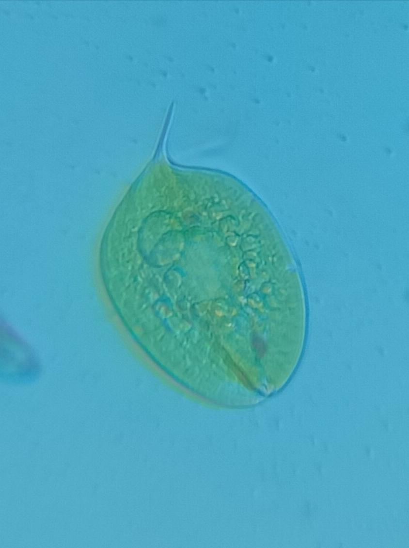 What is Euglena and what are the benefits to the human body? - iMedia