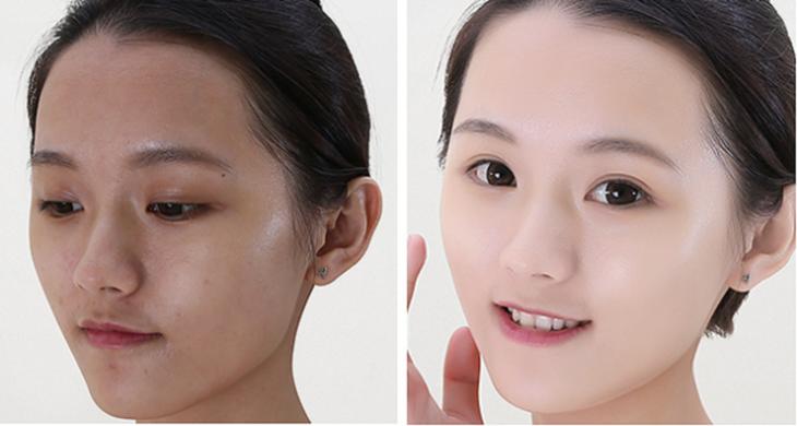 How does the skin turn white from black and yellow?Tell you a whitening ...