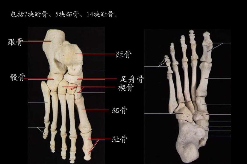 There are 206 bones in the human body. The Chinese generally only have ...