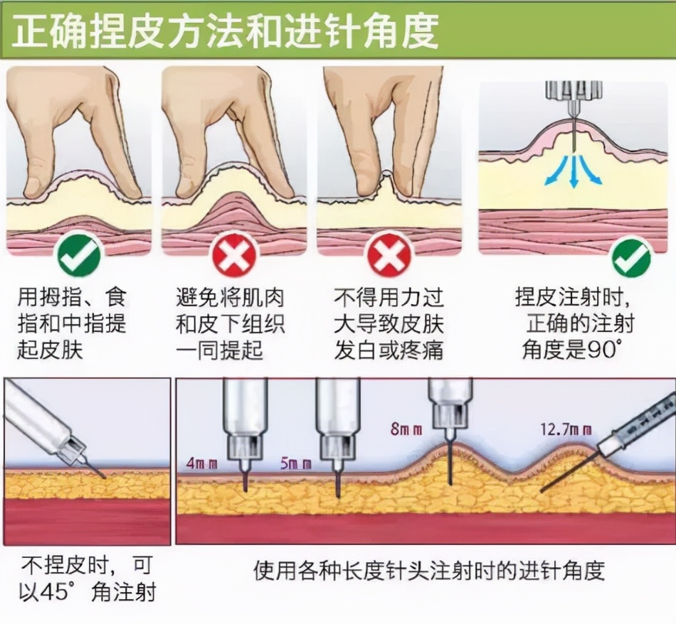 Regarding insulin injection site, injection time, storage method and ...