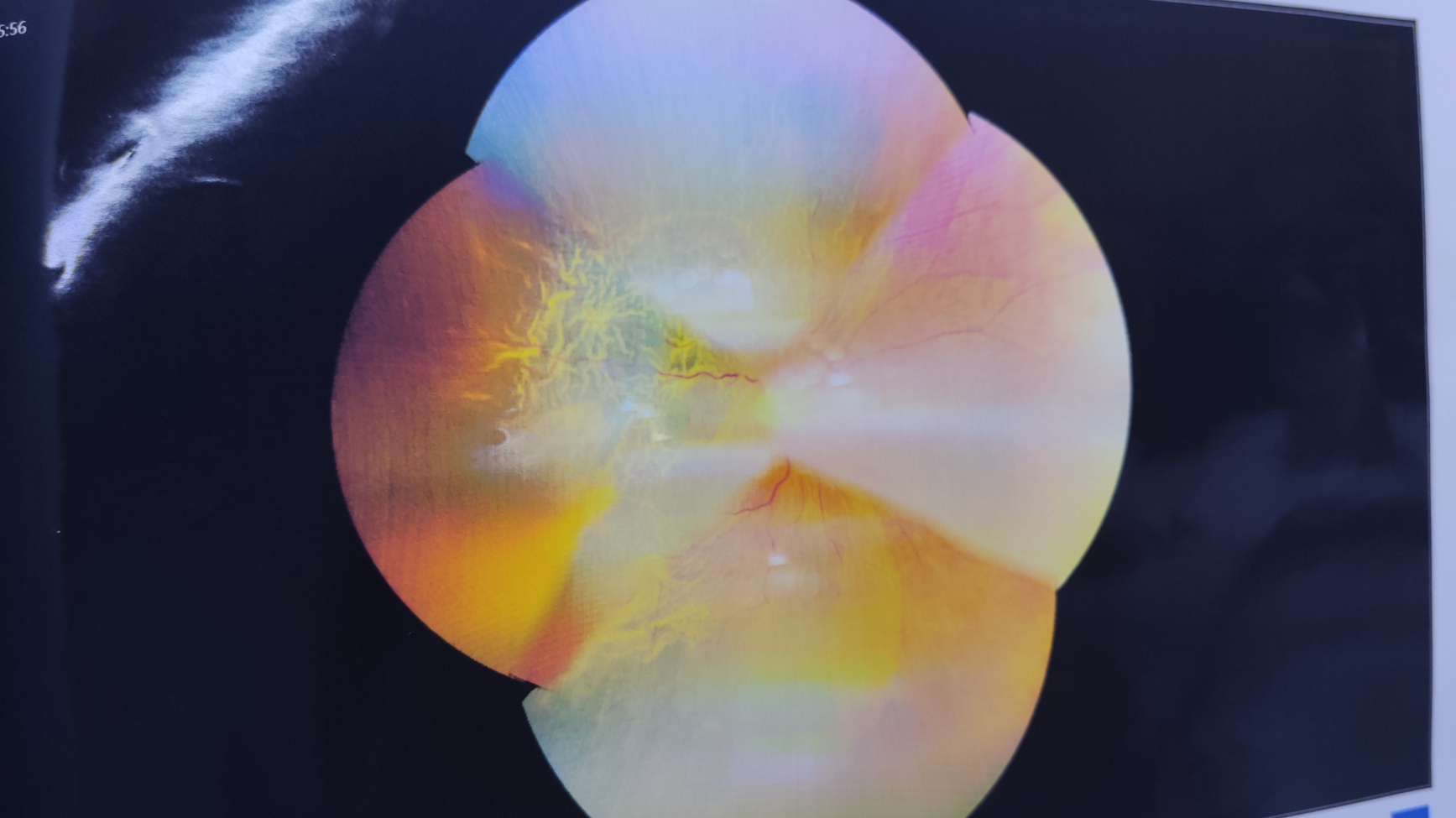 "Fireworks" in the eyes, decreased vision, as everyone knows that it is ...