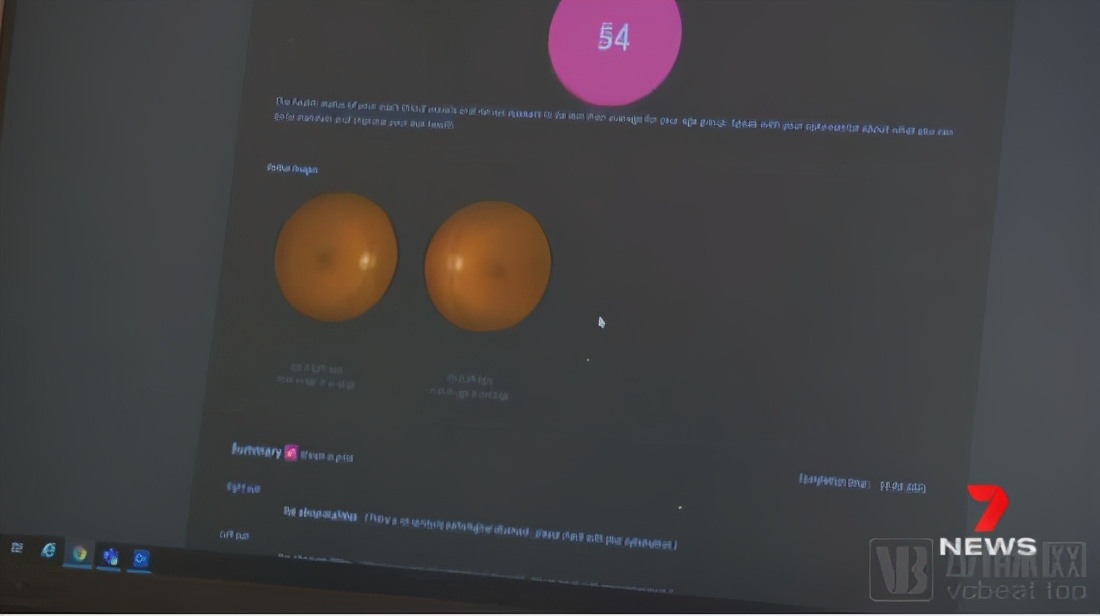 Australian media praises China's AI technology, Eagle Eye Airdoc ...