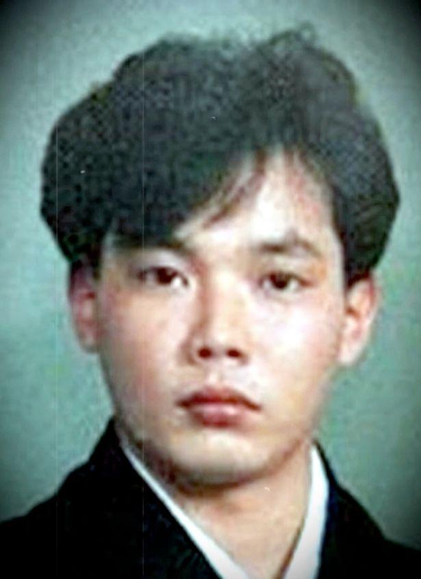 Japanese man suffered nuclear radiation, his skin melted and cried ...