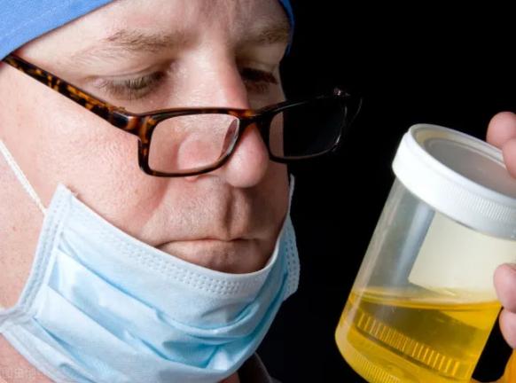 Why does the urine appear cloudy? - iNEWS