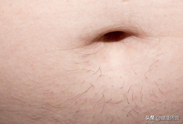 What is the "stinky mud" in the belly button?Can you pull it by hand ...