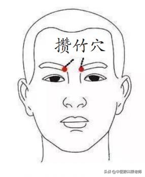 8 acupuncture points, a lot of benefits for eyesight - iNEWS