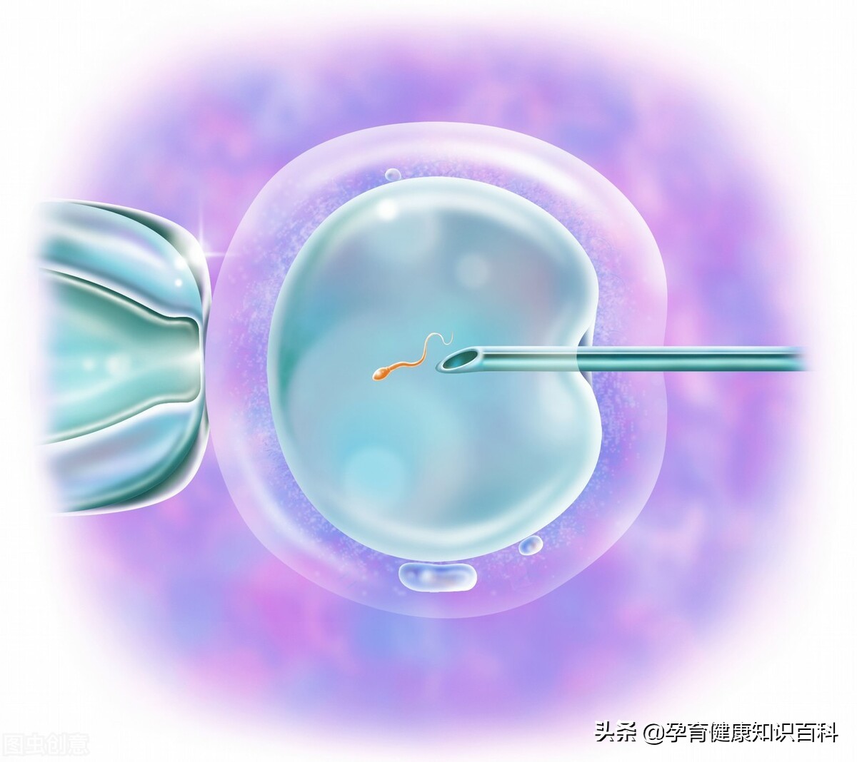 How to choose to be the first generation of IVF? Is the technology ...