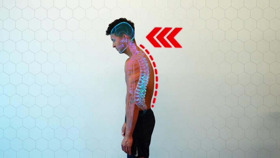 5 simple actions, 10 minutes a day, completely correct the "stooping ...