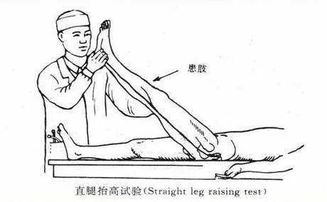 Physical examination of lumbar disc herniation - iNEWS