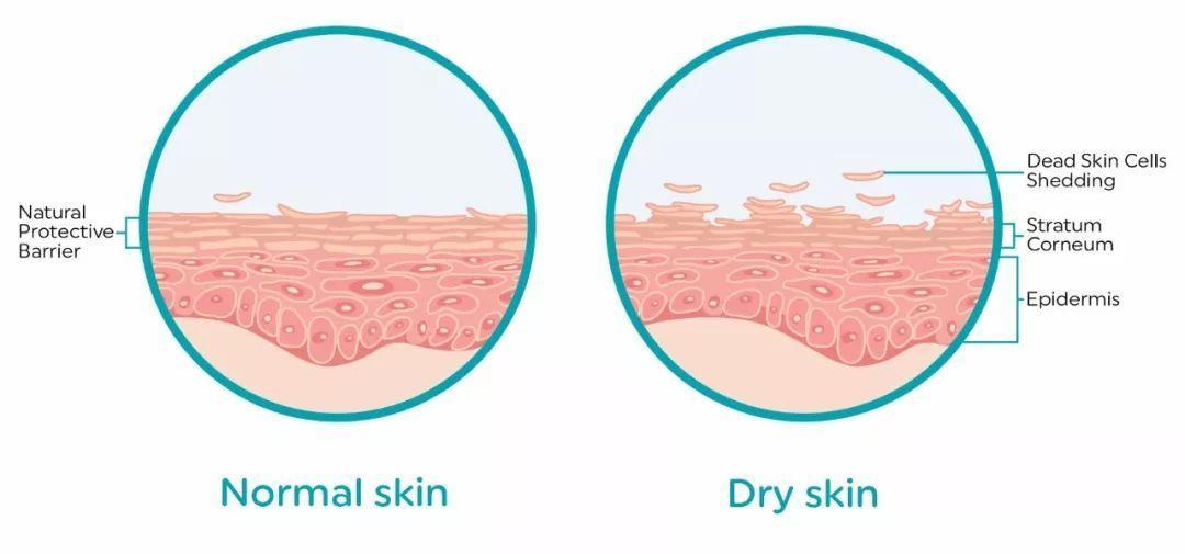 Do you really understand the principle of moisturizing?If you don't ...