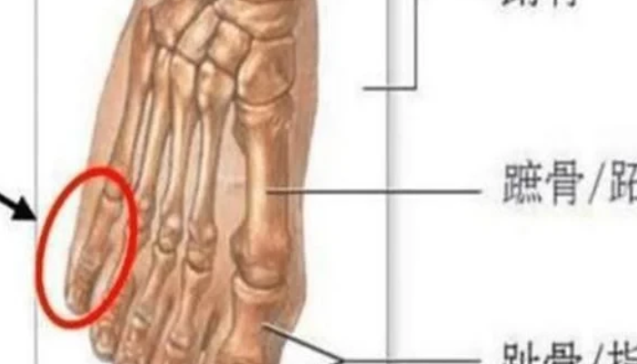 There are 206 bones in total for humans, but only 204 for Chinese. What ...