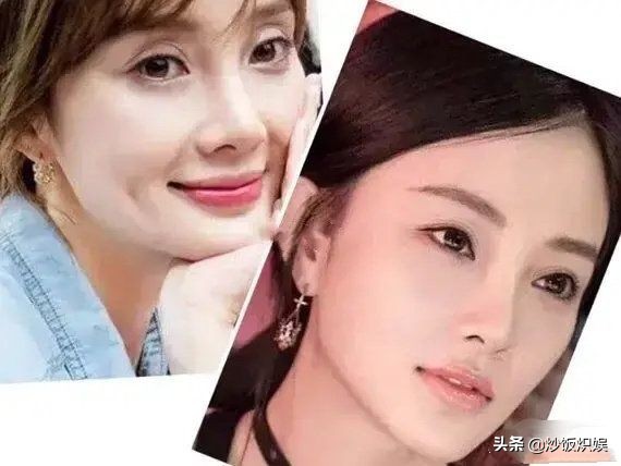 Li Xiaolu has plastic surgery again? Hot dance video with hands ...