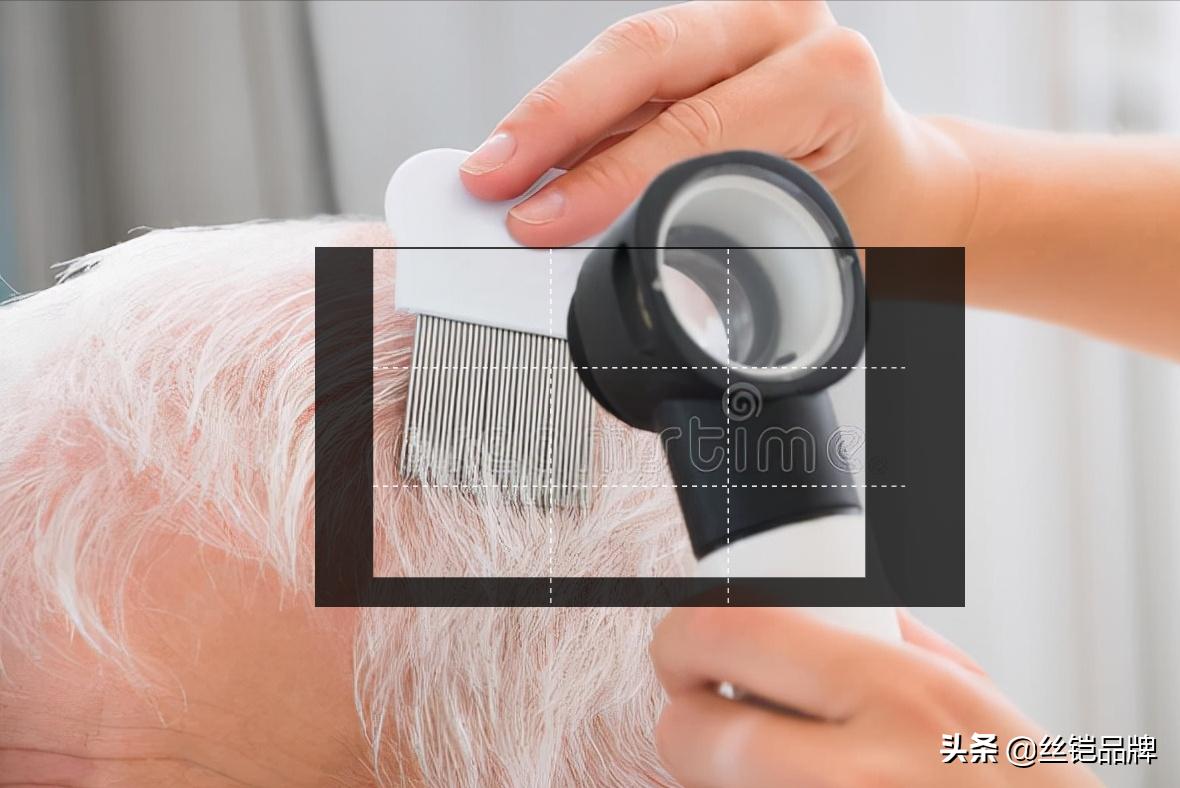 What to do with dry and itchy skin in middle-aged and elderly people in ...