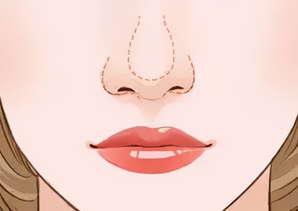 How to improve the garlic nose that expands with the expression - iNEWS