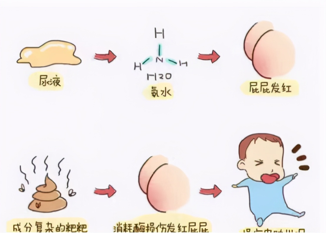 Why does the baby "red butt" do these points, let the baby say "bye bye ...