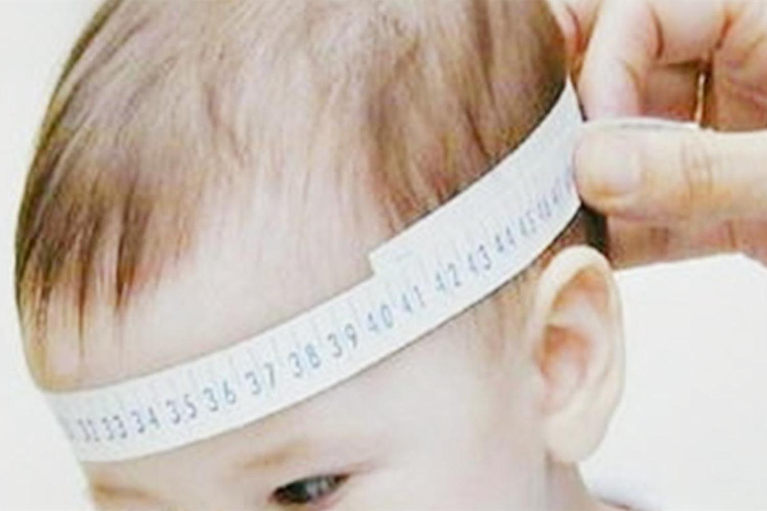 The "diamond-shaped gap" on the top of the baby's head indicates the ...