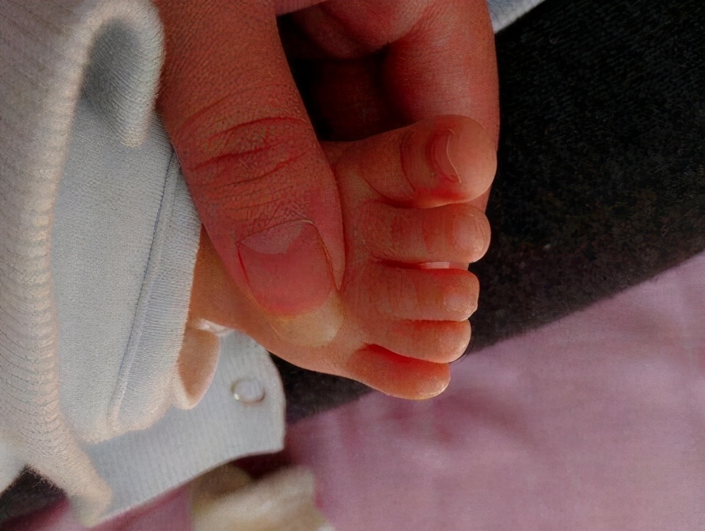 "Long toe baby" became popular, with toes longer than fingers, netizens ...