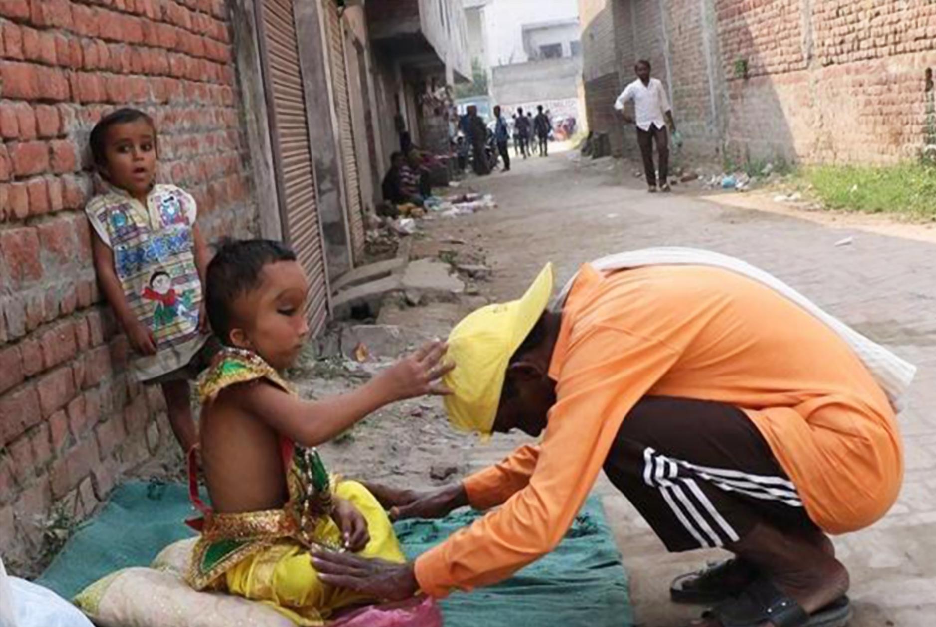 Indian deformed boy: Because he looks like a ganesha, he is revered as ...