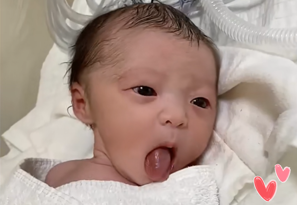 When will the baby's eyes be opened after birth? The sooner you open ...
