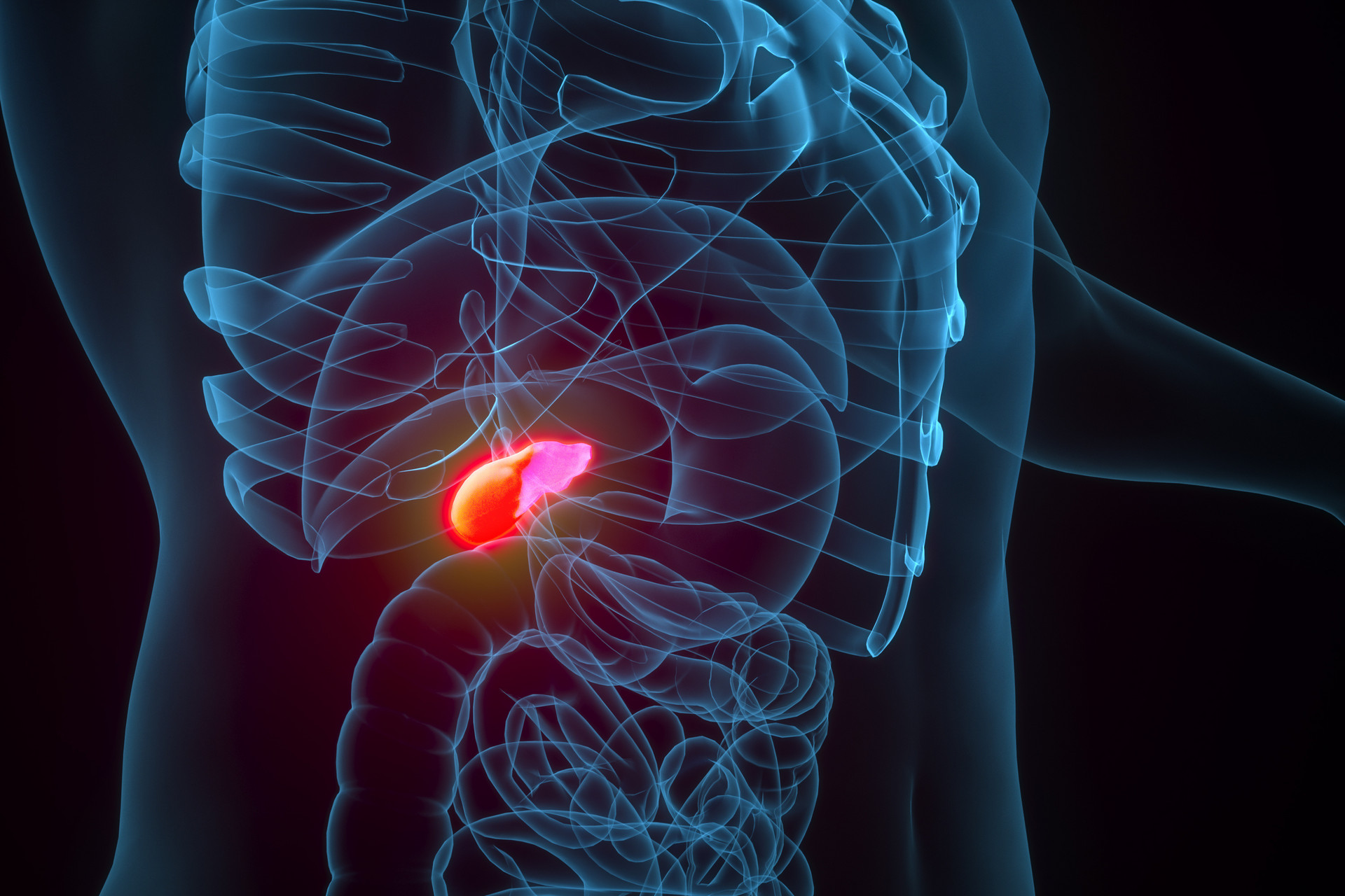 Patients with gallbladder cancer: After the gallbladder is removed, can ...