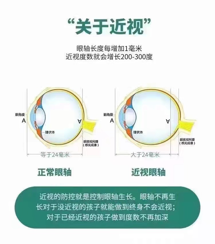 The eye axis is elongated by 1 mm, and myopia is increased by 300 ...