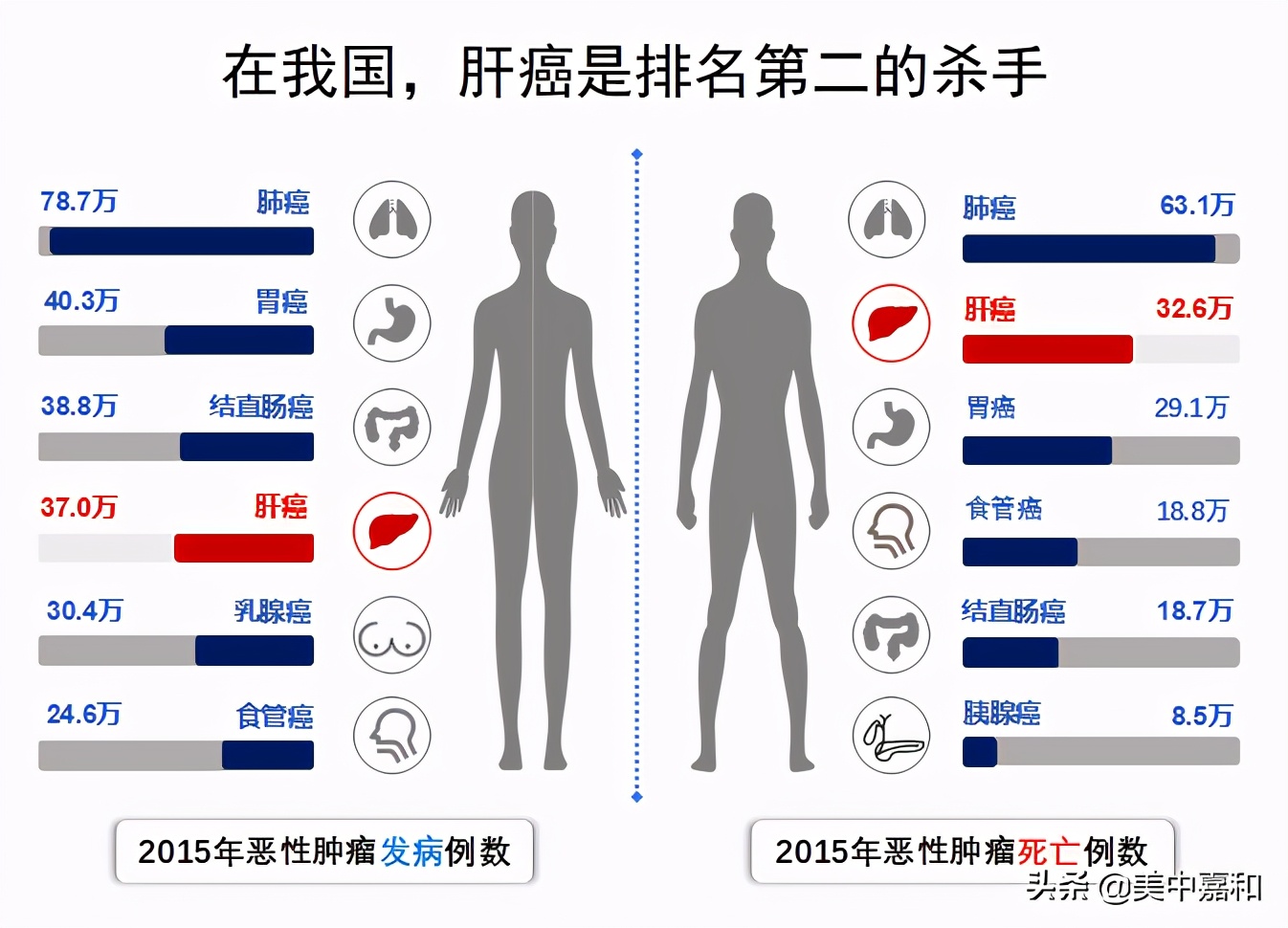 Wu Mengda was diagnosed with liver cancer after Zhao Yingjun. Why are ...