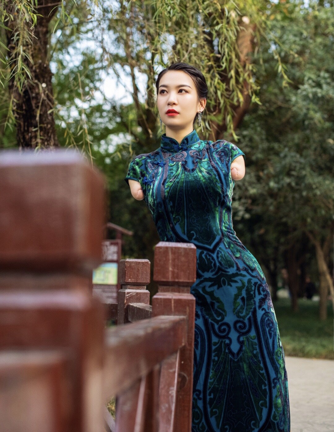 "Broken Arm Girl" Lei Qingyao: If beauty has a rank, then I must be the ...