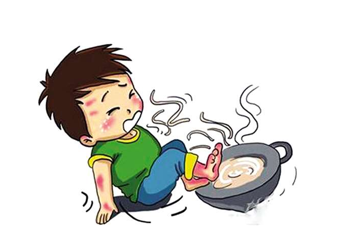 What to do if my child has been scalded by hot water! First take off ...