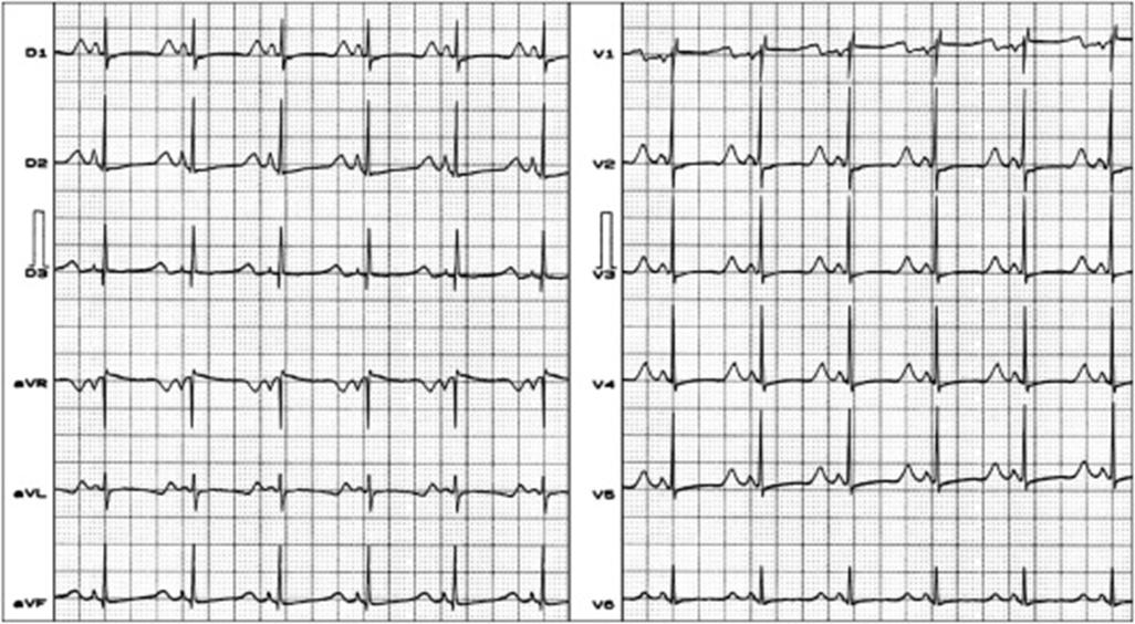 The sudden death of three young people is embarrassing. How can death ...