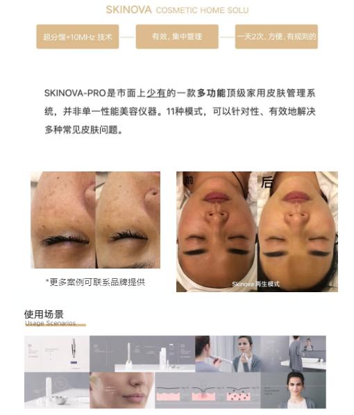 Skinova Beauty Apparatus, a professional and simple German skin care ...