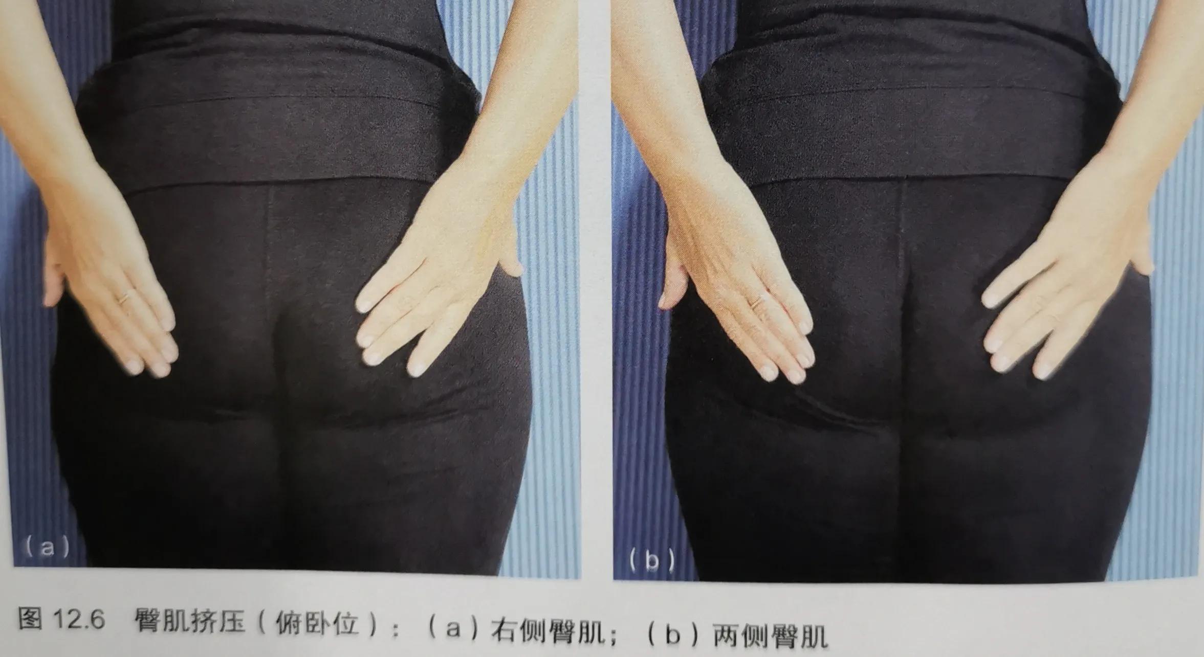 Forward pelvis for posture assessment - iNEWS