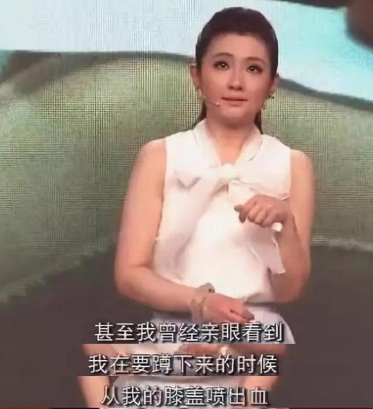 "Goddess of misery" Ren Jiaxuan, who suffered severe burns and was ...