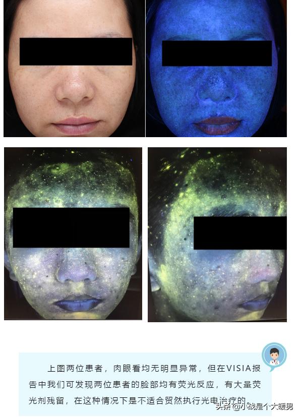 Dark yellow skin with spots?1 skin care tips to remember, let you ...