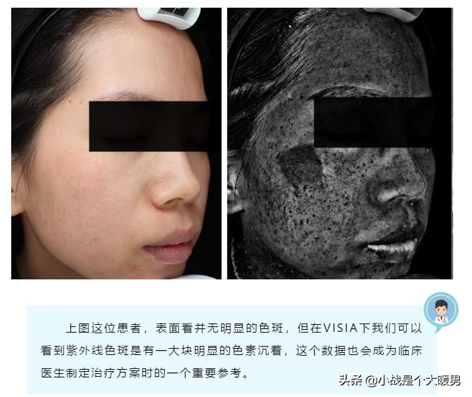 Dark yellow skin with spots?1 skin care tips to remember, let you ...