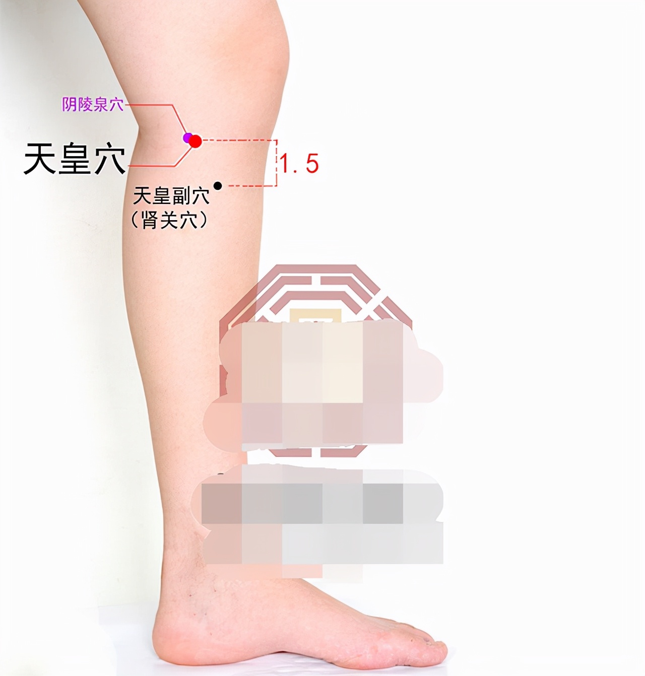 TCM acupuncture upper extremity disease prescription 2 - iNEWS