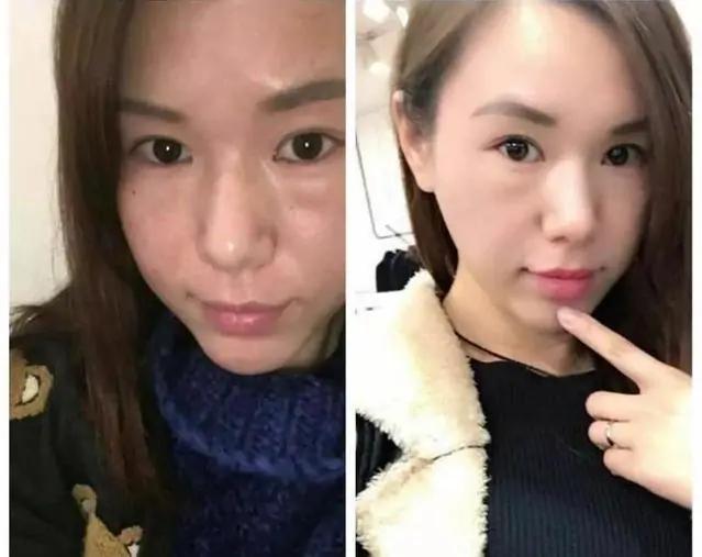 The Vietnamese girl got plastic surgery because she was too ugly, and ...