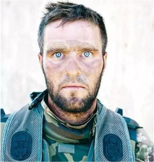 How terrible is the war? Look at the comparison pictures of the faces ...