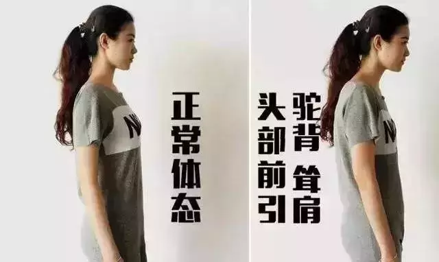 7 moves to stay away from the chested hunchback, create a tall posture ...