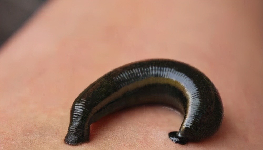 A Hong Kong doctor was arrested for sprinkling salt on a snail. Why ...