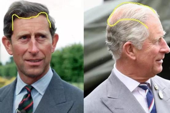 The prince is "bald", and the princess has bulging mouth and buck teeth ...