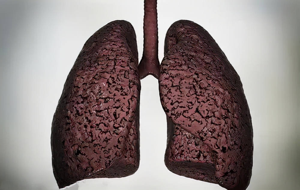 What is the difference between a hard pack and a soft pack of ...