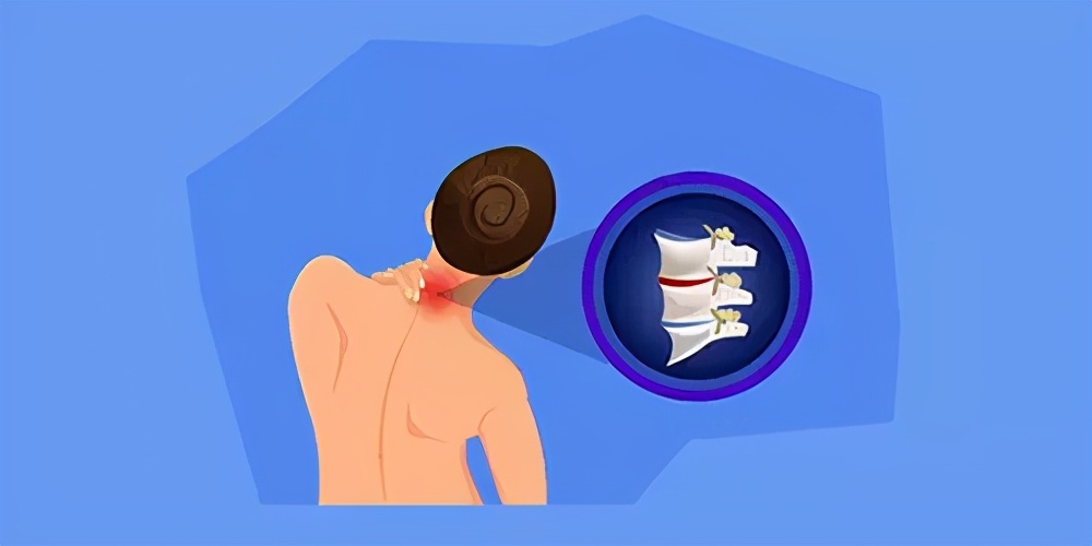 What is going on when you twist your neck and rattle? - iMedia