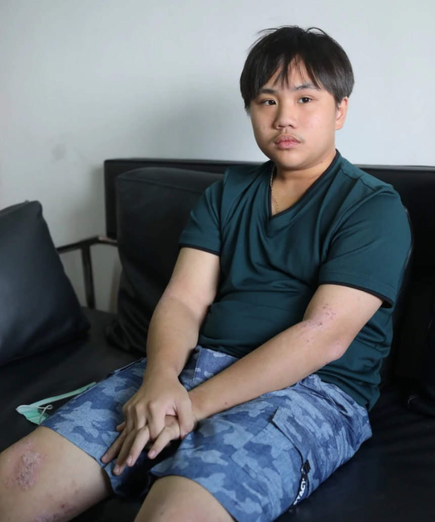 16-year-old Xiaobin returns, the former famous child star becomes a fat ...