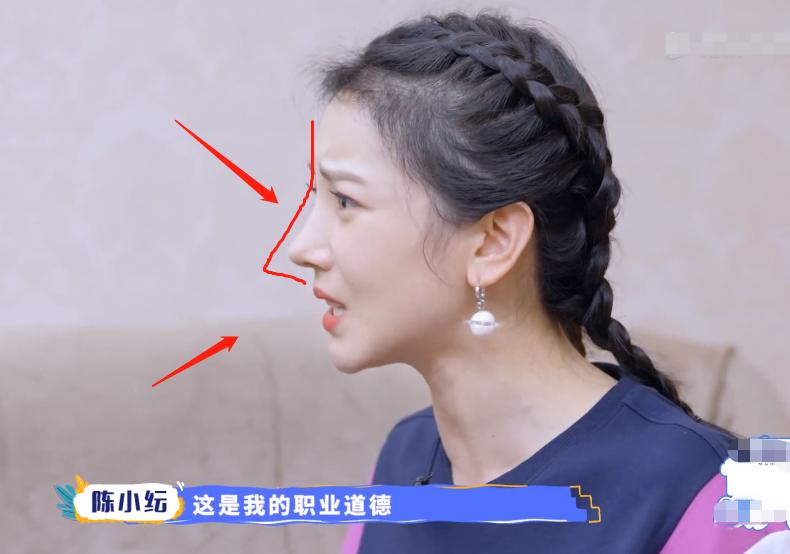It is said that Chen Xiaojun's "repair" was very successful, and his ...